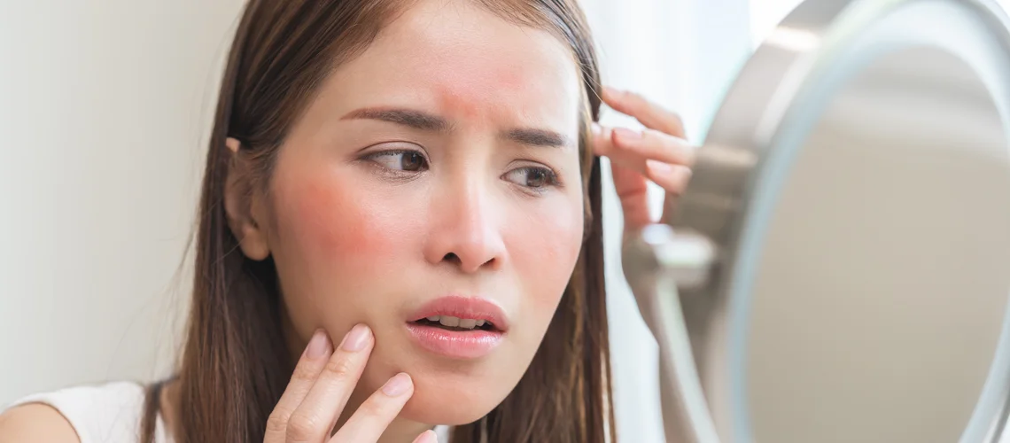 Can You Be Allergic to Botox? Understanding Risks