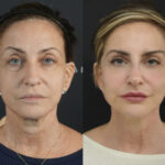 Get Refreshed | America's Most Trusted Brand In Aesthetics.